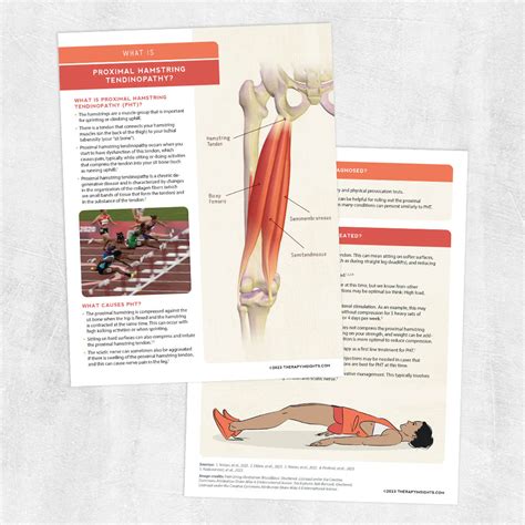 Proximal Hamstring Tendon