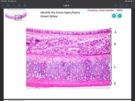 Bio 207 Respiratory Histology Flashcards Quizlet