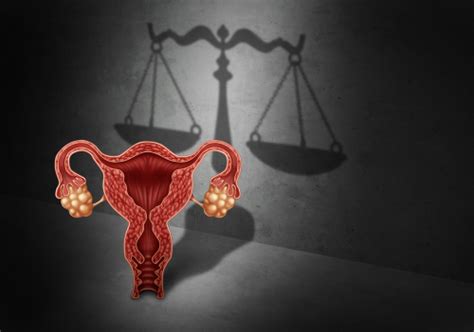 What Are Reproductive Rights Sbemp Attorneys Llp