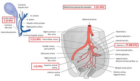 Management And Outcome Of Women With Placenta Accreta Spectrum And