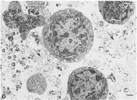 An Electron Micrograph Of Gradient Fraction 4 Of The Ficoll Download Scientific Diagram