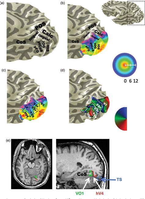 Posterior Transverse Collateral Sulcus Semantic Scholar