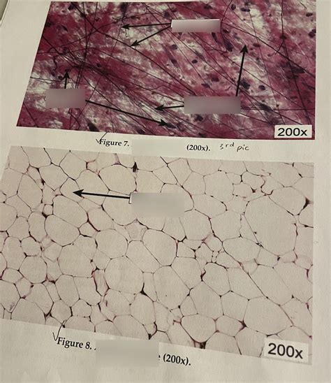 Art And Adt 7 And 8 Diagram Quizlet