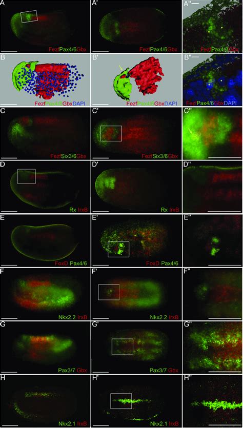 Precise Genetic Boundaries Define Three Major Anteroposterior Ap