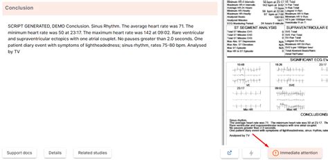 Report A Holter Procedure Cardioscan