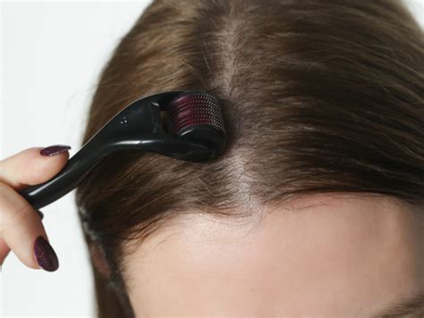 Side Effects Of Derma Roller For Hair Growth Yastrid Medical