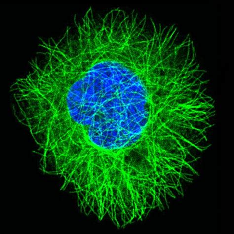 Ralf Sigmund On Linkedin 🧬🔗 Altered Intercellular Communication