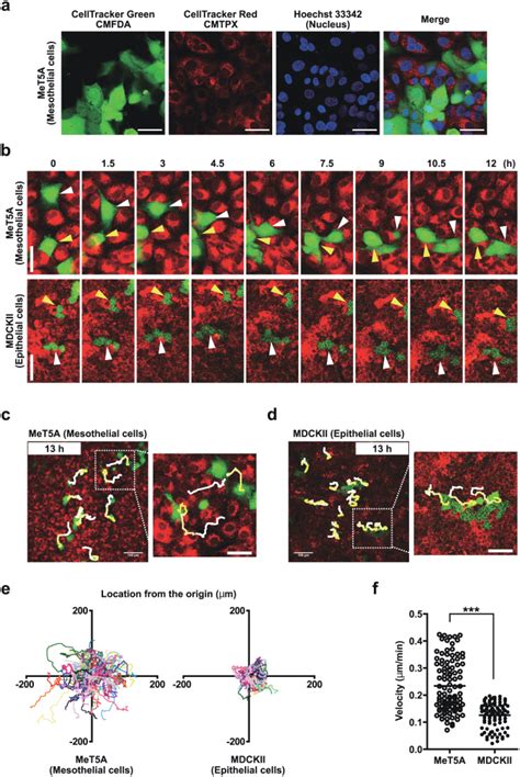 Metamorphosis Of Mesothelial Cells With Active Horizontal Motility In