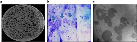 Resorption Pits On Dentin Slices A Bone Slice B And Osteo Assay Download Scientific