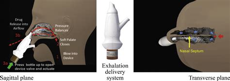 References In Navigate Ii Randomized Double Blind Trial Of The