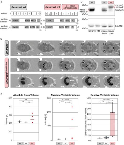 A Carboxy Terminal Smarcb1 Point Mutation Induces Hydrocephalus Formation And Affects Ap 1 And