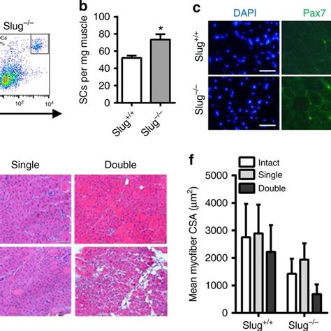 Slug Deficiency Repairs Regenerative Capacity Of Scs During Serial
