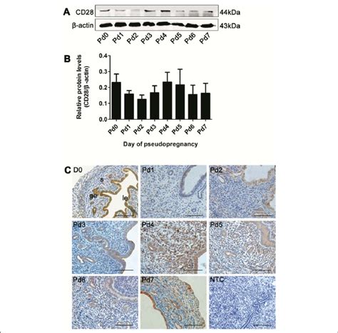 Expression Of Cd28 Protein In The Uteri During Early Pseudopregnancy