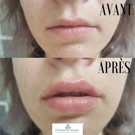 Centres De Médecine Esthétique Dr Philippe Sillard Geneva