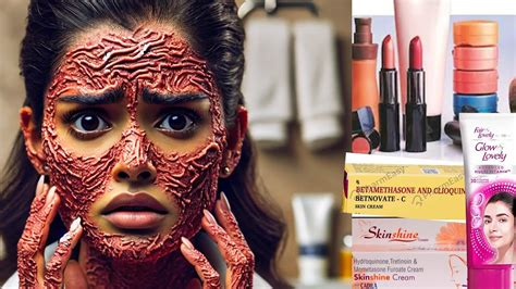 Cosmetic Products Destroy Your Face Side Effect Of Cosmetic Product