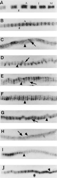 Phase Contrast Micrographs Of Normal A And Download Scientific Diagram