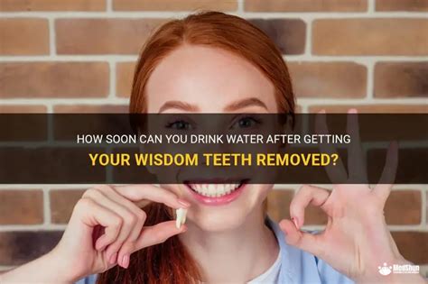 Can U Drink Water After Wisdom Teeth Removal Detroit Chinatown