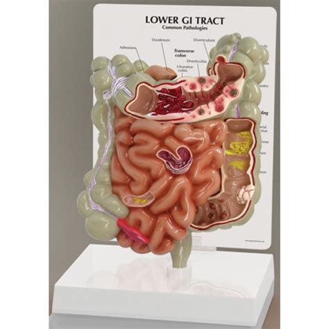 Gi Tract Budget Model
