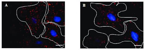 The Influence Of No Us Treatment On Integrin Clustering A B The