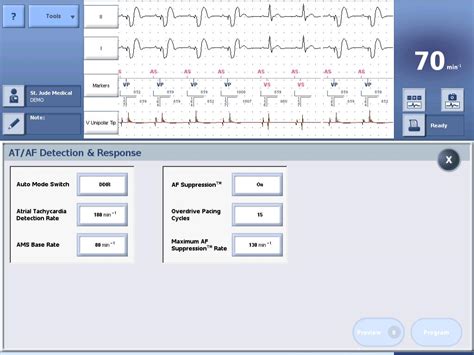 Ppt Af Suppression ™ Powerpoint Presentation Free Download Id3383672