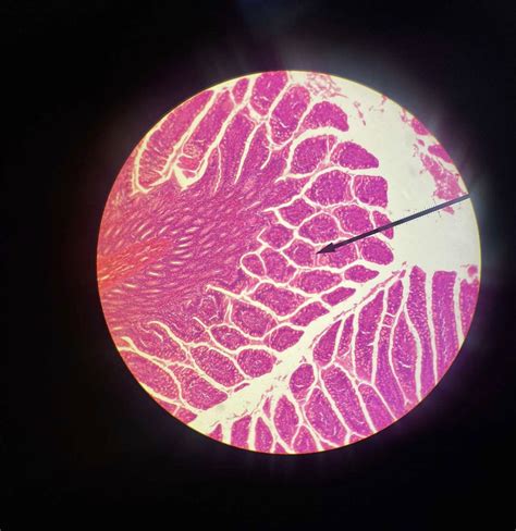 Simple Columnar Epithelium In Duodenum Jejunum