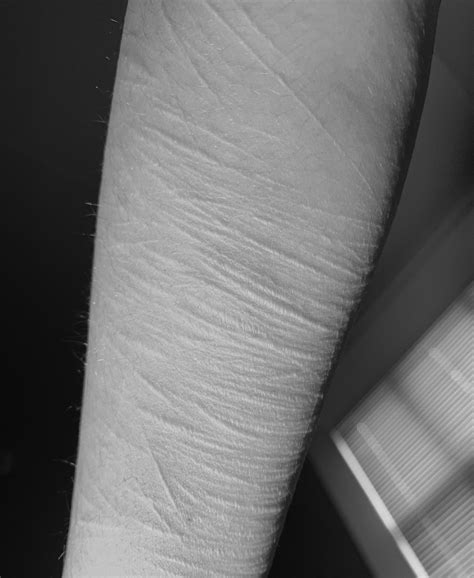 Self Harm Scars Black And White Tumblr Premium Photo Woman Covered