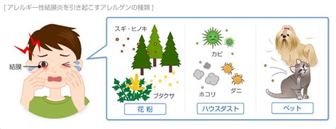目のかゆみの症状・原因｜くすりと健康の情報局