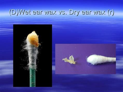 Earwax Color Meanings Wet Dry Orange Brown And More 49 Off