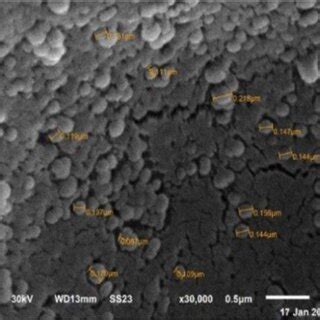Scanning electron microscope (SEM) of F5 NPs. | Download Scientific Diagram