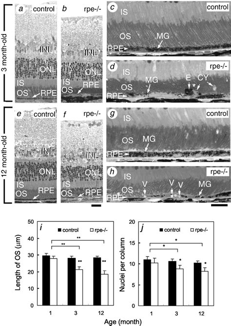 Histological Abnormalities In Rpe And Neural Retina Of Adult Rxr Rpe Download Scientific