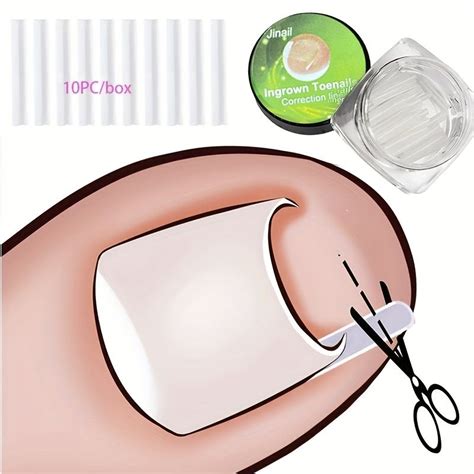 Ingrown Toenail Tool Ingrown Toe Nail Ingrown Elastic Patch Sticker