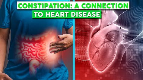 Constipation A Connection To Heart Disease Youtube