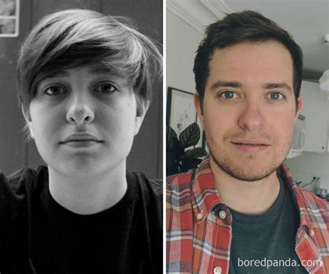 10 Fotos Que No Podrá Creer Del Antes Y Después De Personas Que