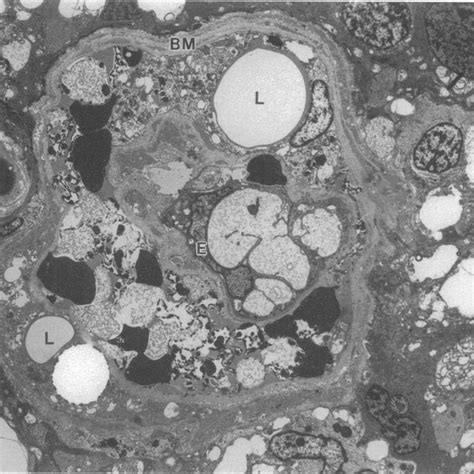 Pdf Histological And Ultrastructural Investigation Of Retinal