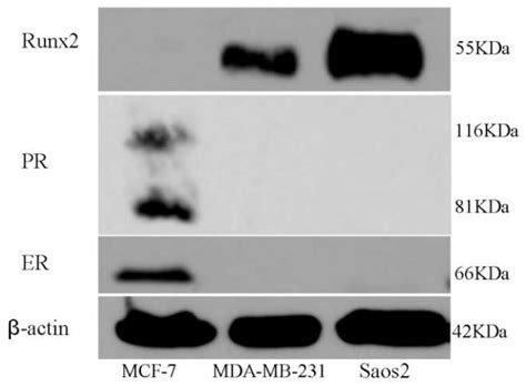 Positive Association Between Nuclear Runx2 And Oestrogen Progesterone Receptor Gene Expression