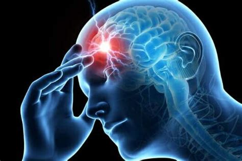 Meloxicamrizatriptan Combo Under Review For Migraine Treatment Mpr