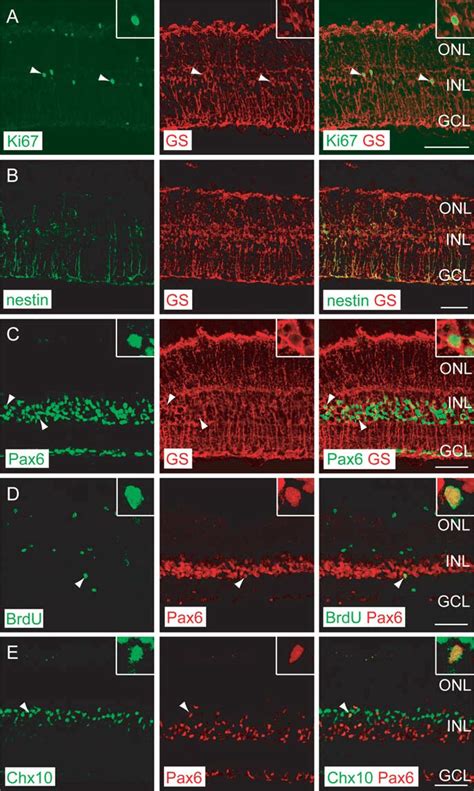 Generation Of Retinal Progenitor Like Cells From Müller Glia In The