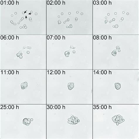 Time Lapse Microscopy Of Cell Migration And Proliferation Live Cells