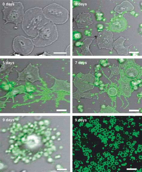 Confocal Microscopy Of Platelets Staining Using Fluorescein Download Scientific Diagram