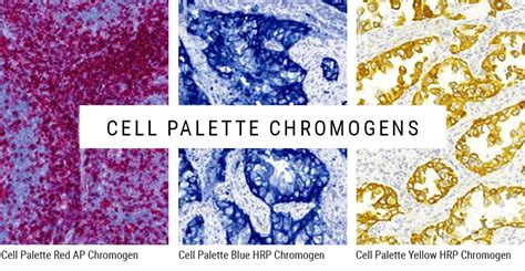 Chromogens And Ihc Reagents Ihc And Ish