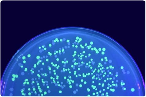 Single Particle Tracking In Biology