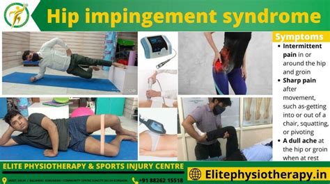 Hip Impingement Syndrome