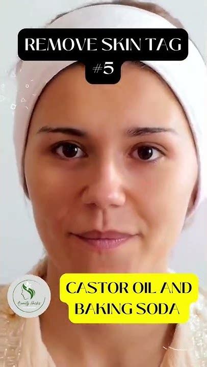 Removing Skin Tag With Castor Oil And Baking Soda Youtube