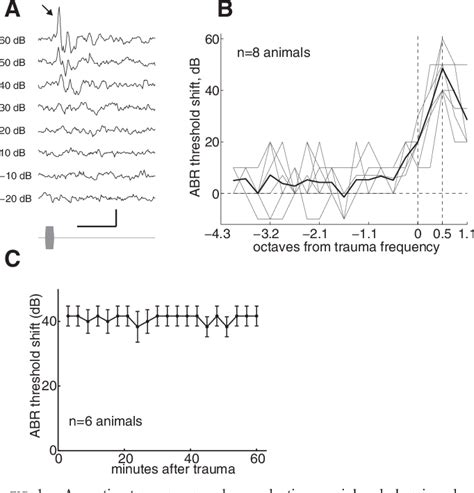 Figure 1 From Disruption Of Balanced Cortical Excitation And Inhibition