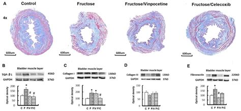 Urinary Bladder Fibrosis And Fibrogenesis Markers In Experiment Groups