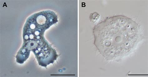 Parasite Of The Day Acanthamoeba Spp