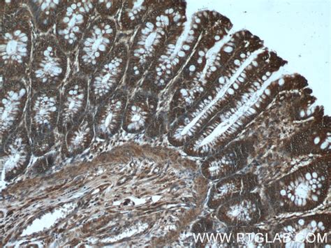 Pparg Fusion Protein Ag16657 Proteintech