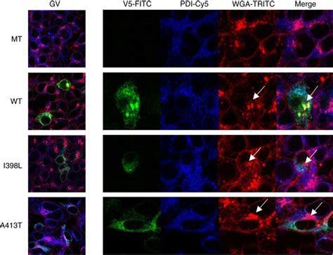 Subcellular Localization Of Wt I398l And A413t Fi Subcellular