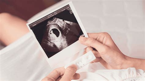 Gestational Sac In Early Pregnancy Meaning Growth And Risks Thomson Medical