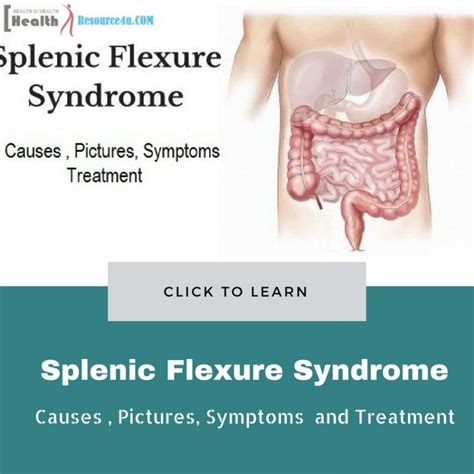 Splenic Flexure Syndrome Causes Pictures Symptoms And Treatment